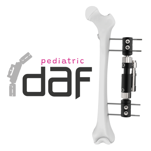 External Fixation – PediTST